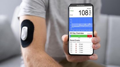 Continuous Glucose Monitoring (CGM) Sensors: Revolutionising Diabetes ...